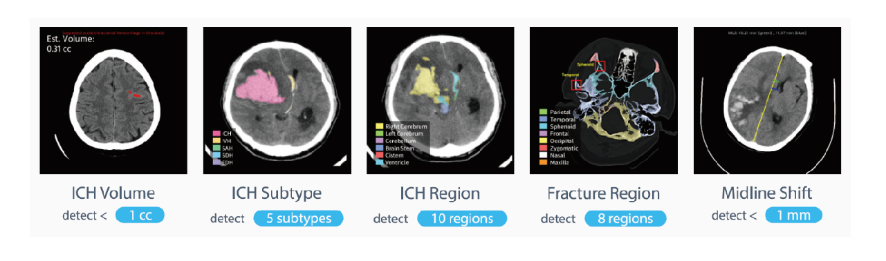 ACCEL-VM500 powered by NVIDIA RTX platform which support Deep01 brain imaging AI recognition ...